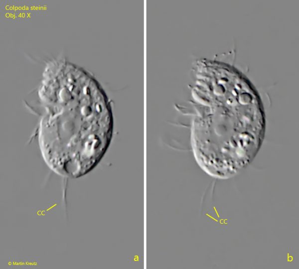 Colpoda steinii – Real Micro Life