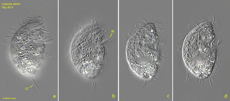 Colpoda steinii – Real Micro Life