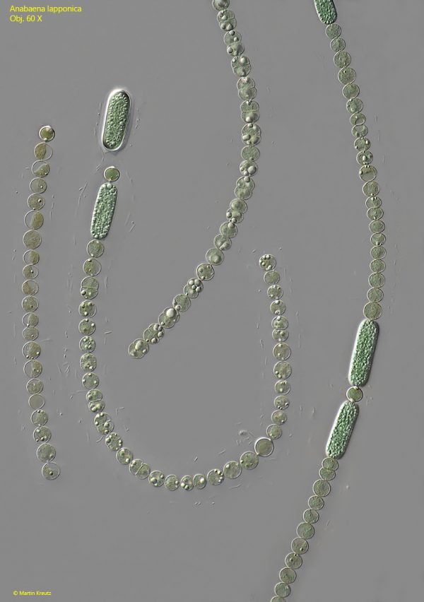 Anabaena lapponica – Real Micro Life