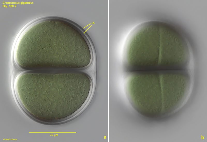 Chroococcus giganteus – Real Micro Life