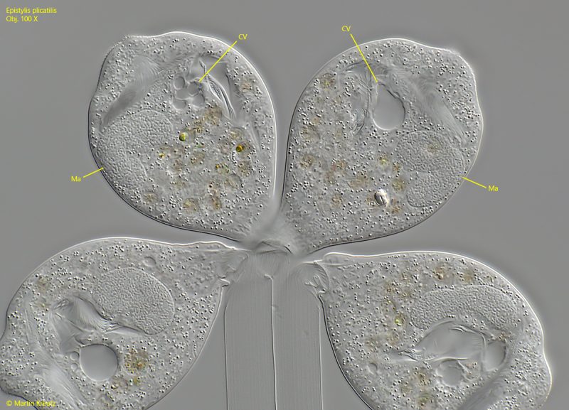Epistylis plicatilis – Real Micro Life
