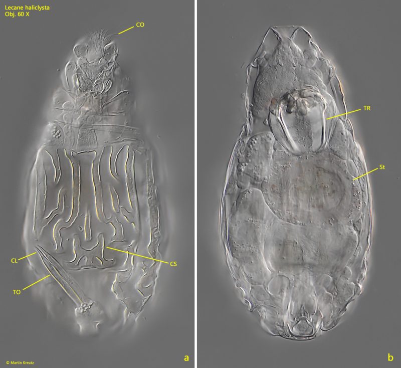 Lecane haliclysta – Real Micro Life