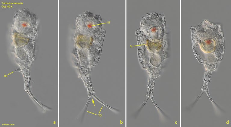 Trichotria tetractis – Real Micro Life