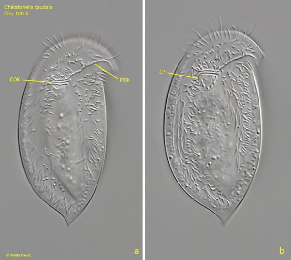 Chilodonella caudata – Real Micro Life