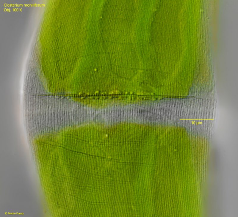 Closterium moniliferum – Real Micro Life
