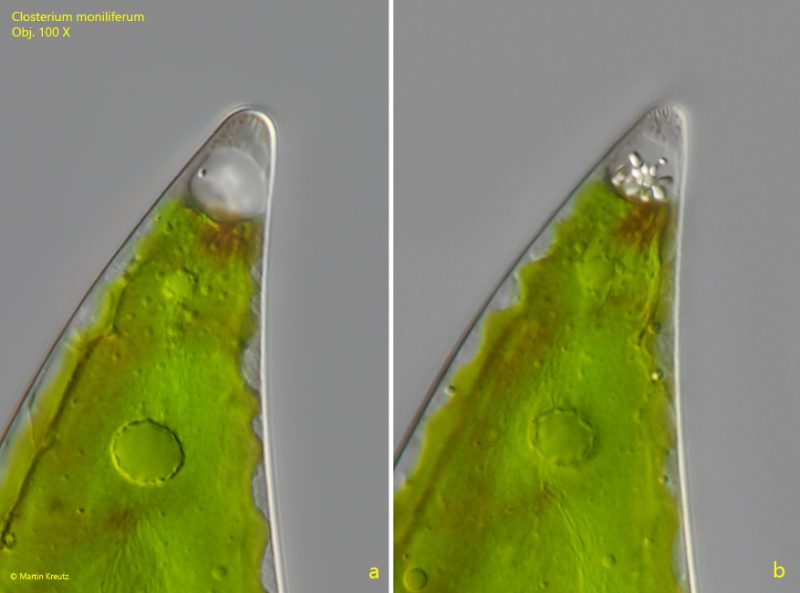 Closterium moniliferum – Real Micro Life