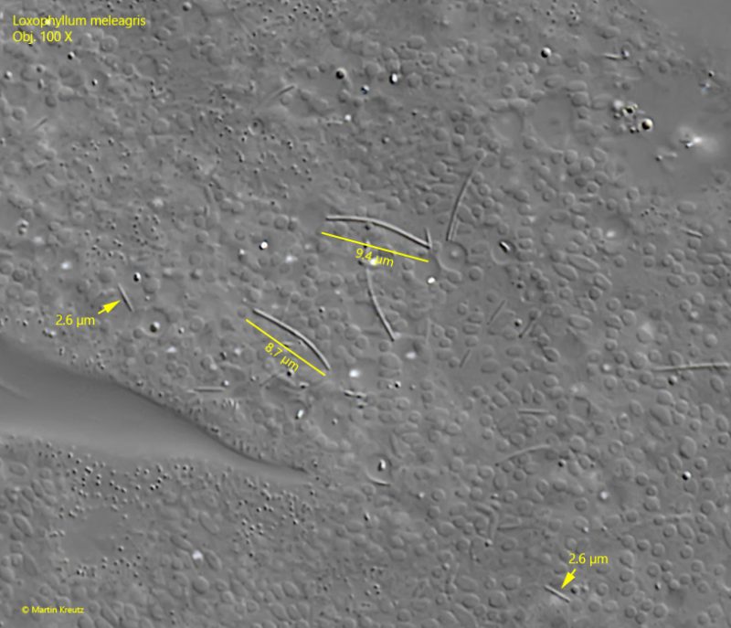 Loxophyllum meleagris – Real Micro Life