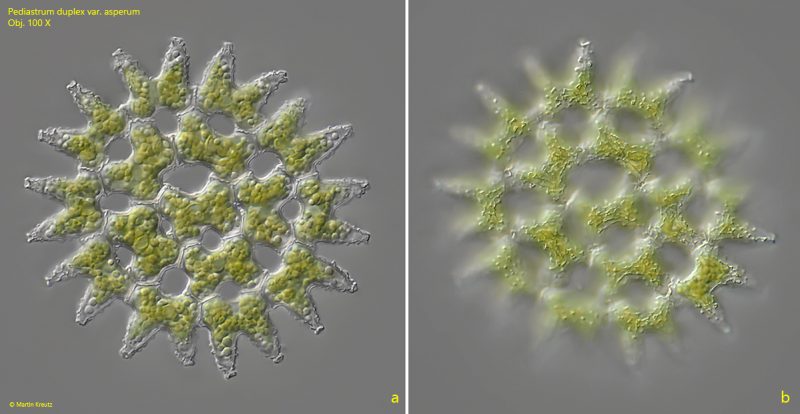 Pediastrum duplex var. asperum – Real Micro Life
