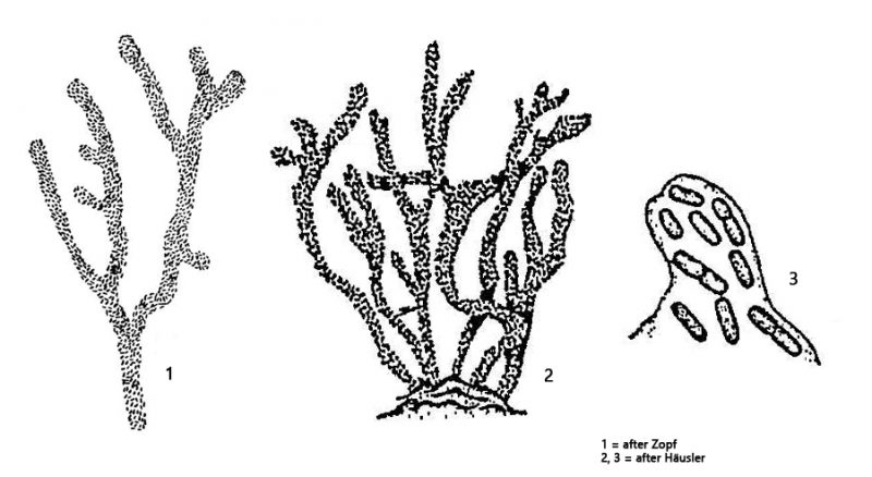 Zoogloea ramigera – Real Micro Life