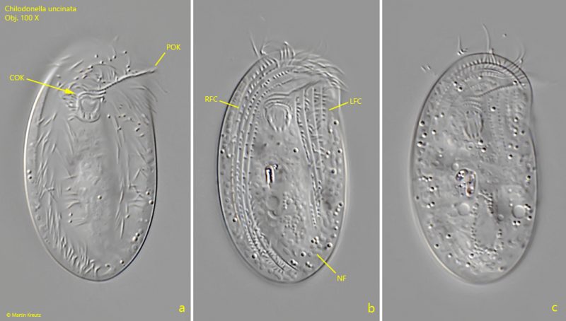 Chilodonella uncinata – Real Micro Life