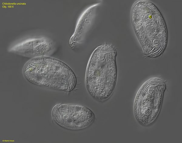 Chilodonella uncinata – Real Micro Life