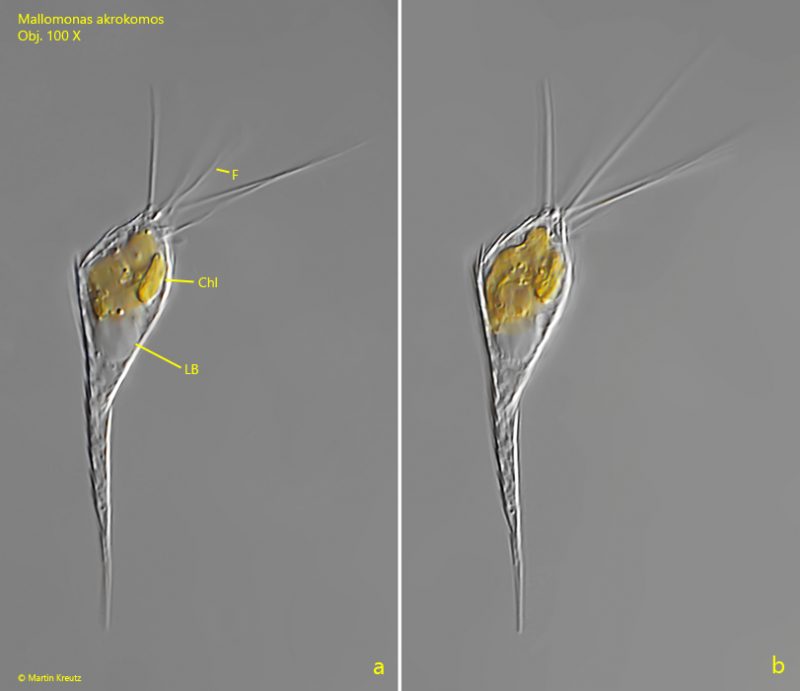 Mallomonas akrokomos – Real Micro Life