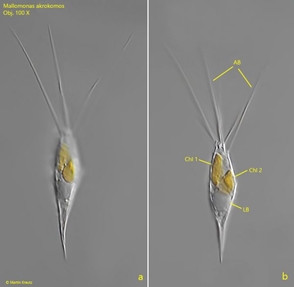 Mallomonas akrokomos – Real Micro Life