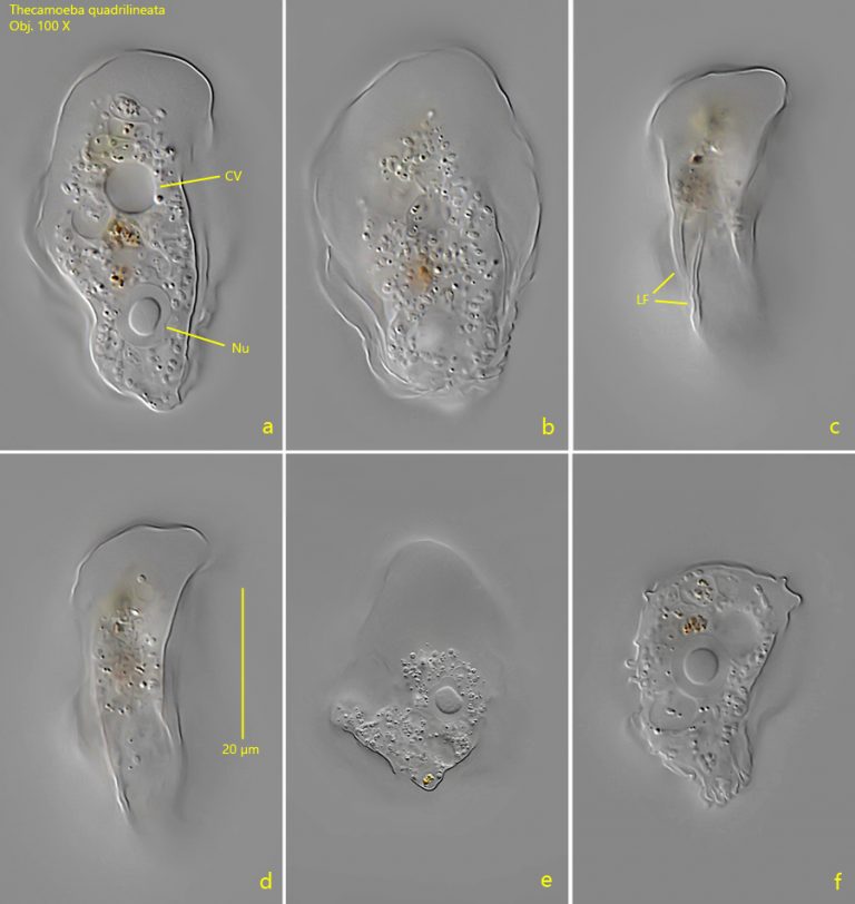 Thecamoeba quadrilineata – Real Micro Life