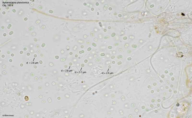 Aphanocapsa planctonica – Real Micro Life