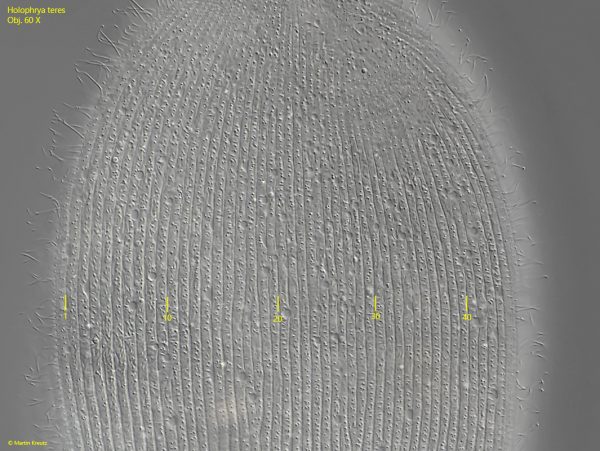 Holophrya teres – Real Micro Life