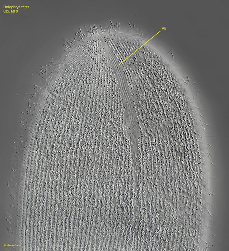 Holophrya teres – Real Micro Life