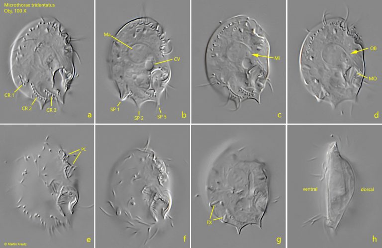 Microthorax tridentatus – Real Micro Life