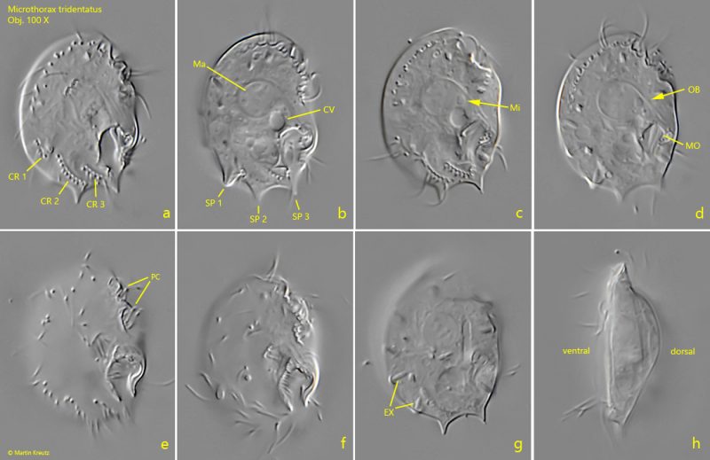 Microthorax tridentatus – Real Micro Life