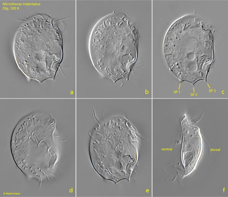 Microthorax tridentatus – Real Micro Life