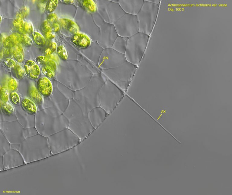 Actinosphaerium eichhornii var. viride – Real Micro Life