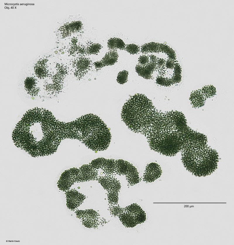 Microcystis aeruginosa – Real Micro Life