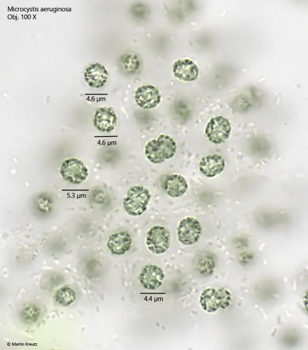 Microcystis aeruginosa – Real Micro Life