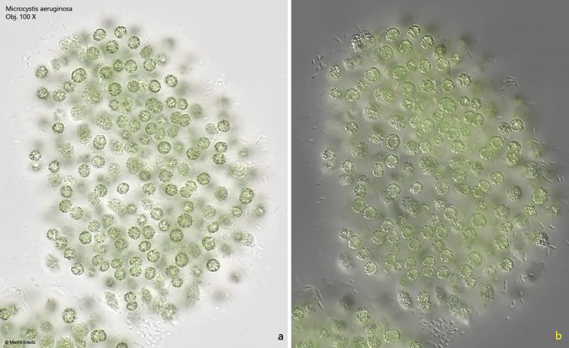 Microcystis aeruginosa – Real Micro Life