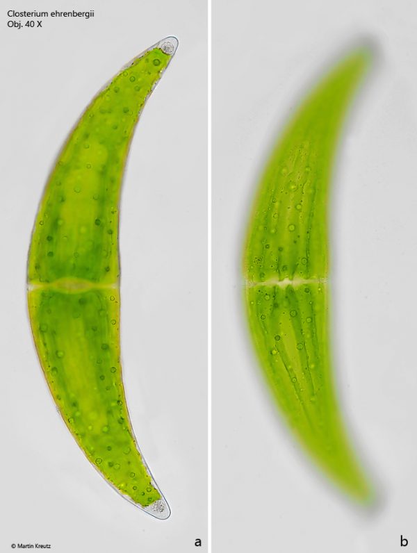 Closterium ehrenbergii – Real Micro Life