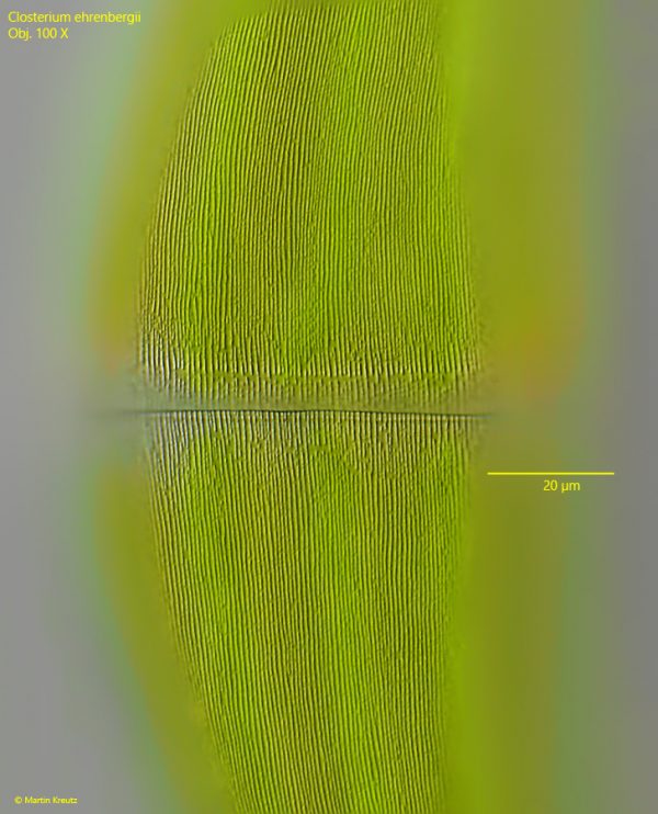 Closterium ehrenbergii – Real Micro Life