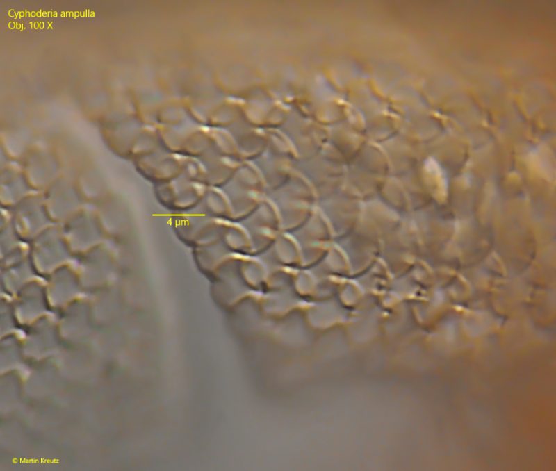 Cyphoderia ampulla – Real Micro Life