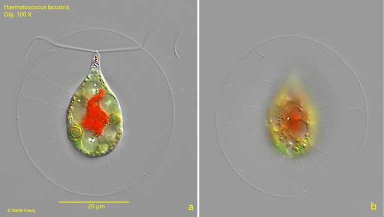 Haematococcus lacustris – Real Micro Life