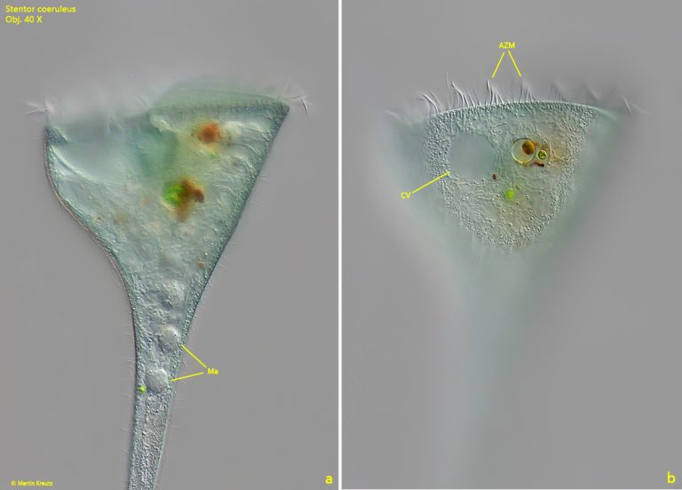 Stentor coeruleus – Real Micro Life