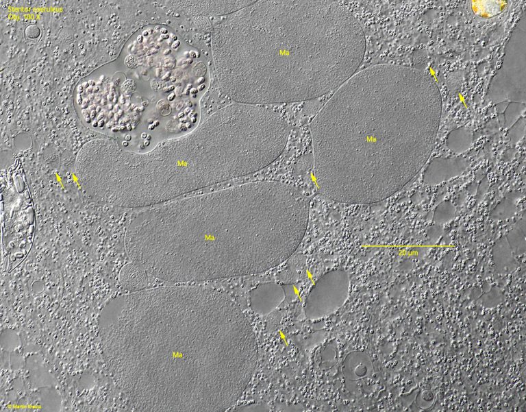 Stentor coeruleus – Real Micro Life