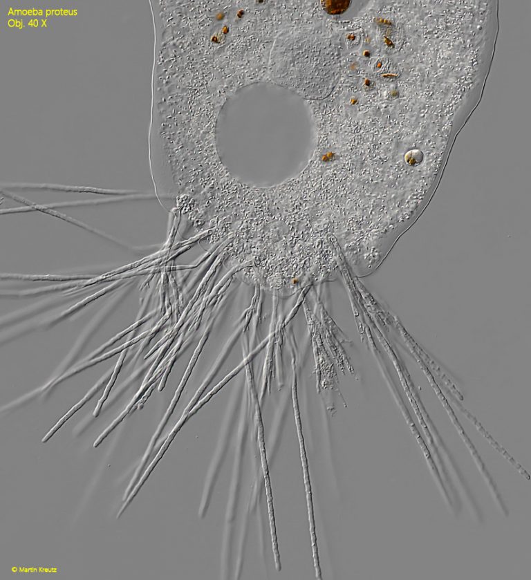Amoeba proteus – Real Micro Life