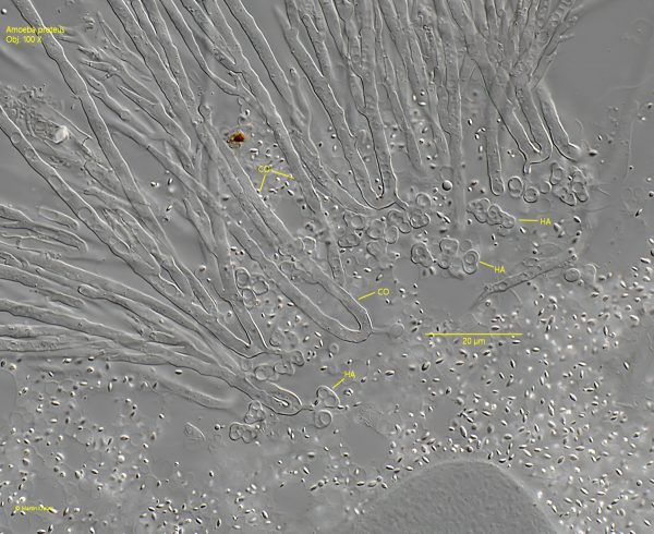 Amoeba proteus – Real Micro Life