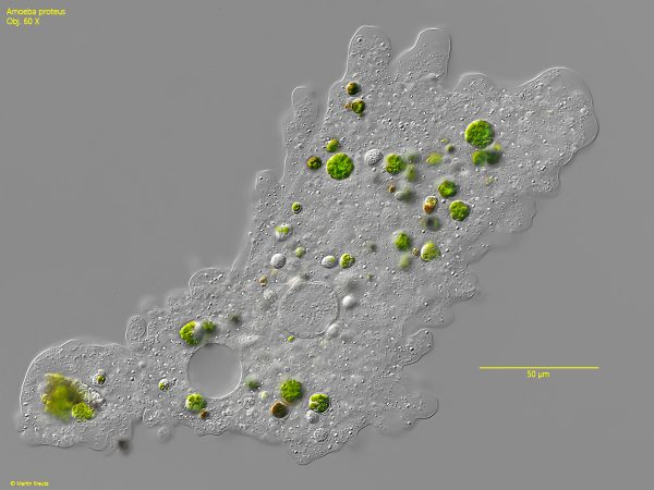 Amoeba proteus – Real Micro Life