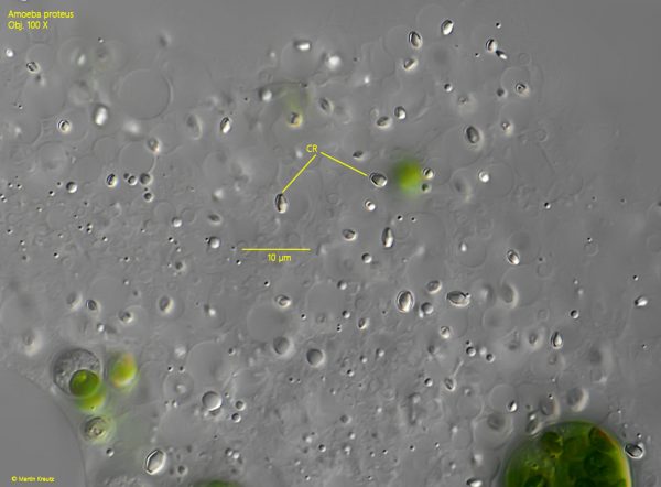 Amoeba proteus – Real Micro Life