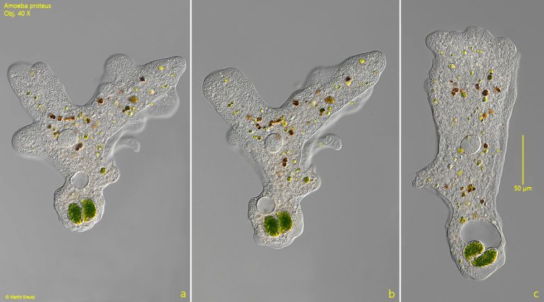 Amoeba proteus – Real Micro Life