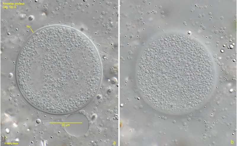 Amoeba proteus – Real Micro Life