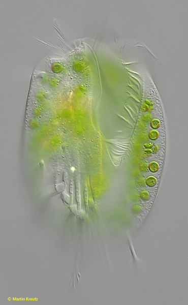 Staurastrum traunsteineri – Real Micro Life