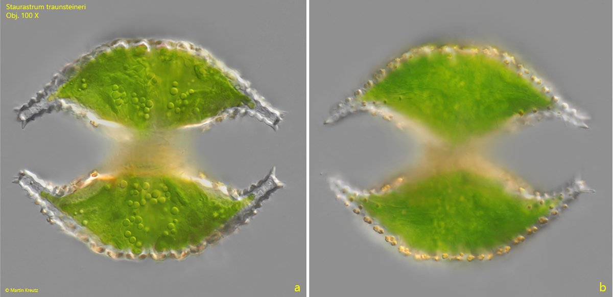 Staurastrum traunsteineri – Real Micro Life