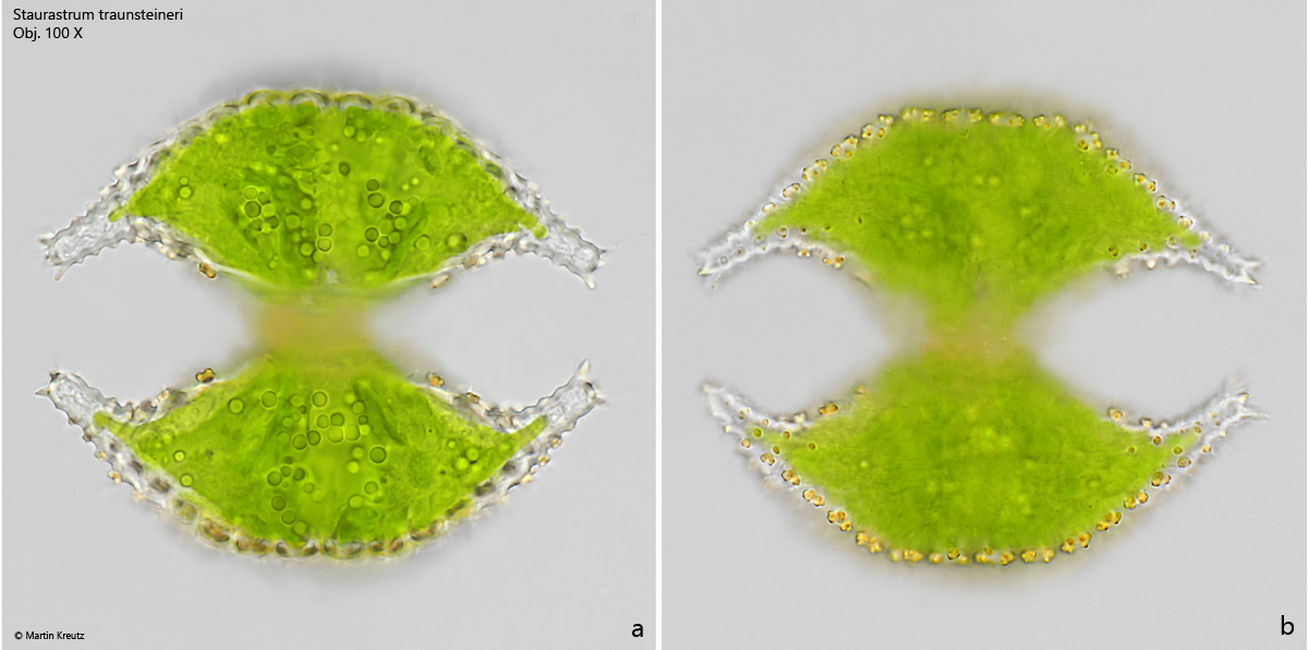 Staurastrum traunsteineri – Real Micro Life